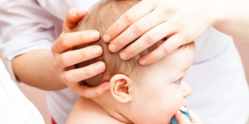 Seboroická dermatitída a ako ju liečiť : La Roche-Posay